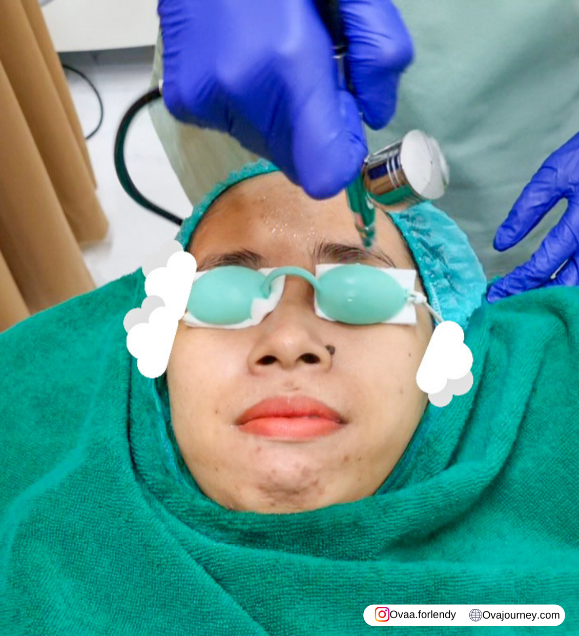 Pengalaman Treatment di Zap Clinic Untuk Meningkatkan Kepercayaan Diri ...